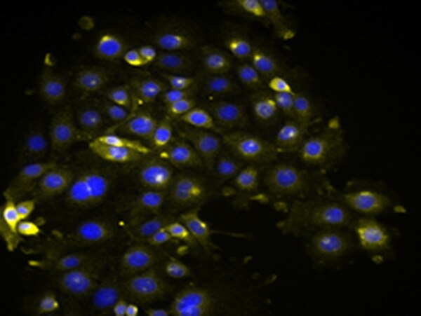 MOC2 Mouse Oral Squamous Cell Carcinoma (OSCC) Cell Line | SCC470